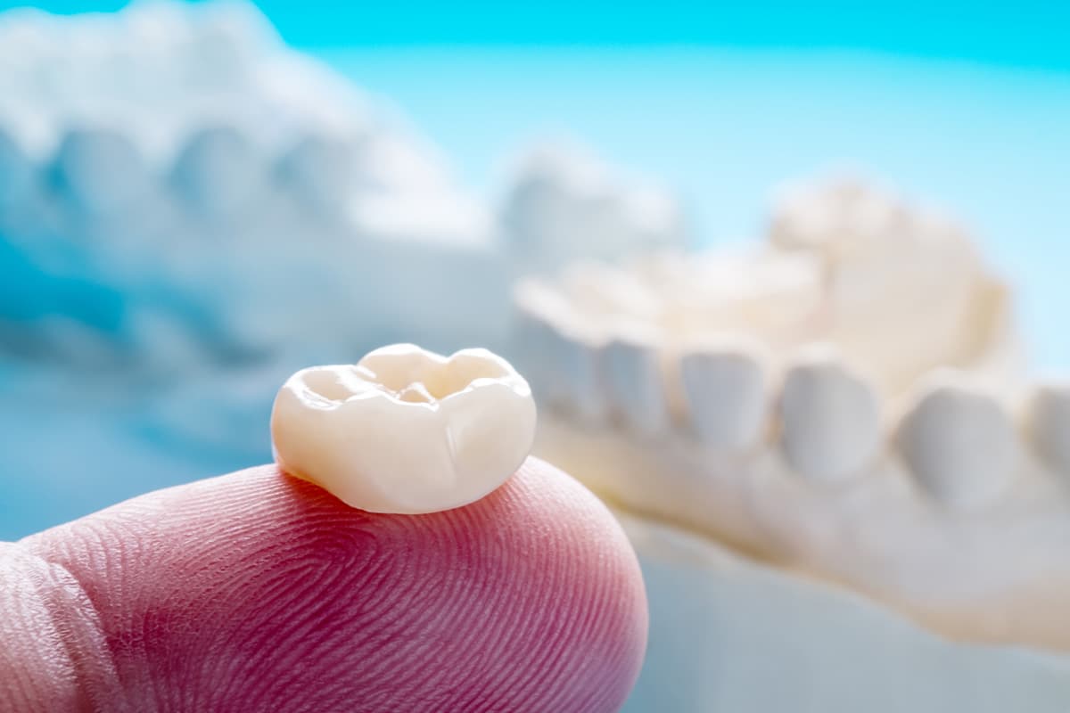 What If There Is Not Enough Tooth For A Crown? | Bisson Dentistry