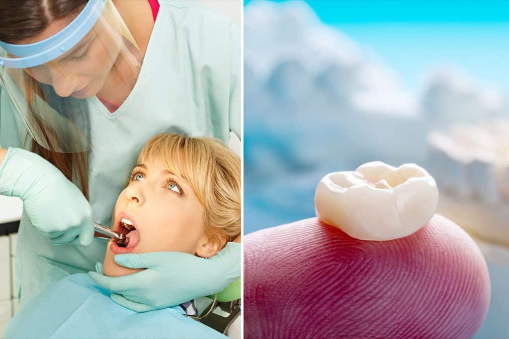 Should I Get a Crown or Pull the Tooth? - Bisson Dentistry